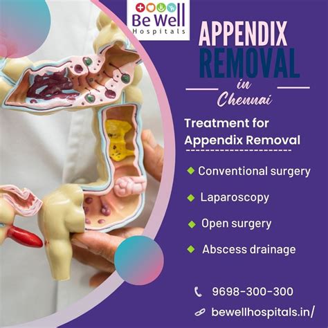 Appendix Removal In Chennai Be Well Hospitals Medium