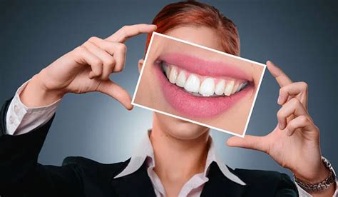 How To Choose The Right Teeth Gap Solution For Your Smile A Platform Of General Latest News