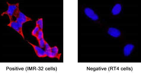 Mchr1 Products Randd Systems