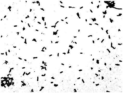 Lactobacillus Reuteri 22 And Application Thereof Eureka Patsnap