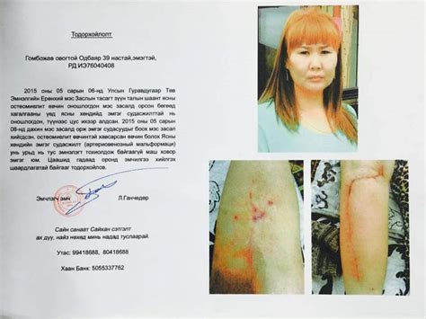 ТУСЧ ГАР Сайн үйлсийн аянд нэгдэхийг уриалж байна