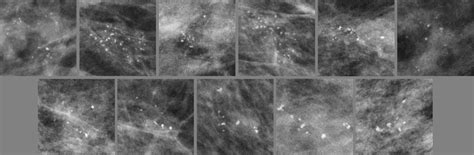 Regions Of Interest Containing The 11 Selected Clusters Of
