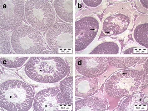 Testicular Histology Of F1 Males At Pnd 90—normal Testicular Histology Download Scientific