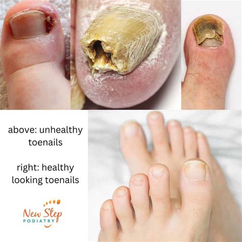 Understanding Healthy Feet What They Look And Feel Like New Step