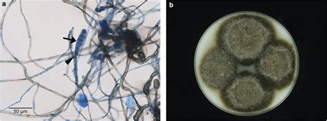 Lactophenol Cotton Blue Stain Showed A Conidium With ≥6 Distoseptate Download Scientific