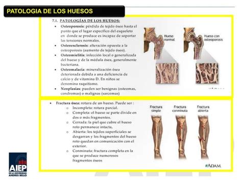 Pptx Clase 4 Patologias Sistema Locomotor Dokumentips Porn Sex Picture