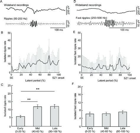 A Representative Example Of An Isolated Ripple 80 200 Hz B Rates Download Scientific