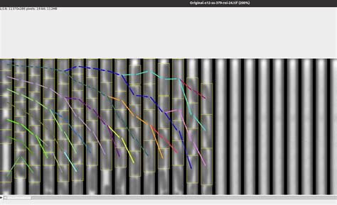Github Yemre Data Ecoli Bacteria Detection