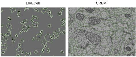 논문 리뷰 Vim Unet Vision Mamba For Biomedical Segmentation