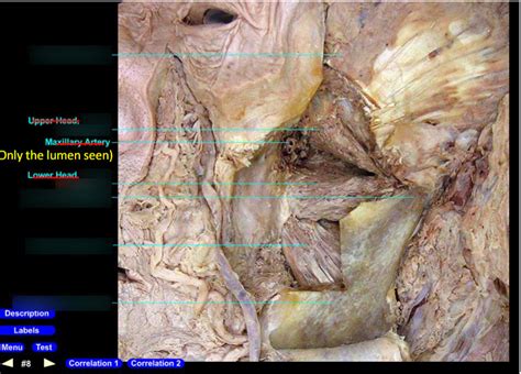 Face Infratemporal Fossa Image 8 Pt 2 Exam 1 Diagram Quizlet