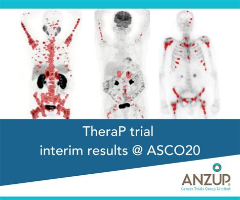 Prof Dr Med Kambiz Rahbar Posted On Linkedin