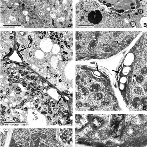 Cell Morphology And Bacteroid Positioning In Alfalfa Nodules