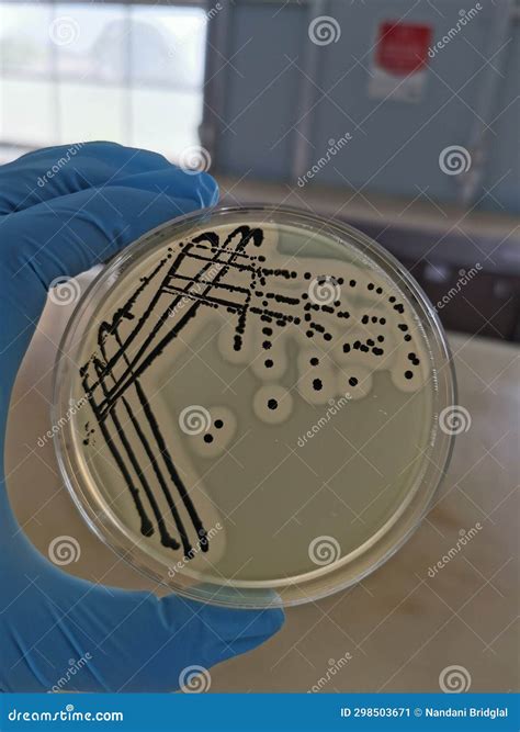 Staphylococcus Aureus On Baird Parker Agar Stock Image Image Of Analysis Parker 298503671