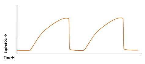 Abnormal Capnography Waveforms And Their Interpretation Deranged Physiology