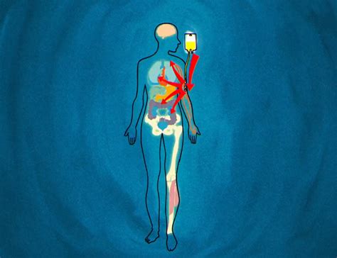 Como Funciona A Quimioterapia