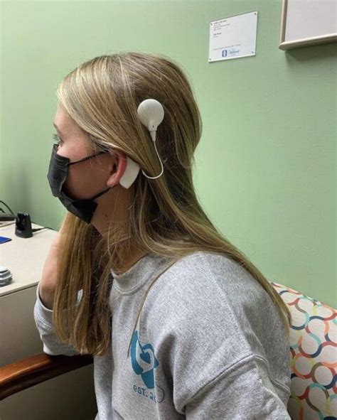 Pin By Lisa D Scott On Cochlear Implant Hearing Aids Cochlear