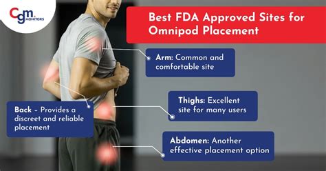 Omnipod Placement Sites Right Body Location To Wear It