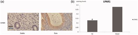 Expression Levels Of LPAR1 In Endometriotic Tissues In Patients With Download Scientific