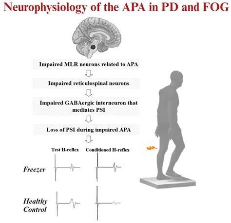 Mesencephalic Locomotor Region And Presynaptic Inhibition During Anticipatory Postural