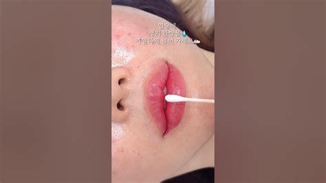 오버립 입술성형반영구💋 Youtube
