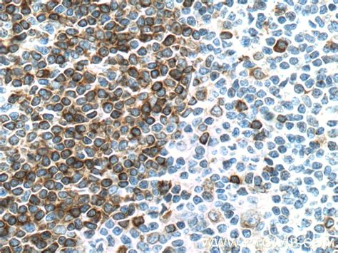 Cd138syndecan 1 Antibody 10593 1 Ap Proteintech