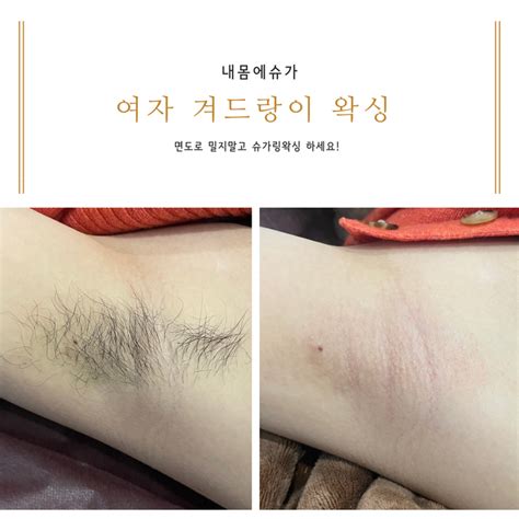 부천왁싱 잘하는 곳 여자겨드랑이 면도하지말고 슈가링왁싱 하세요 네이버 블로그