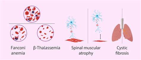 What Are Monogenic Disorders Classification And Most Common Types