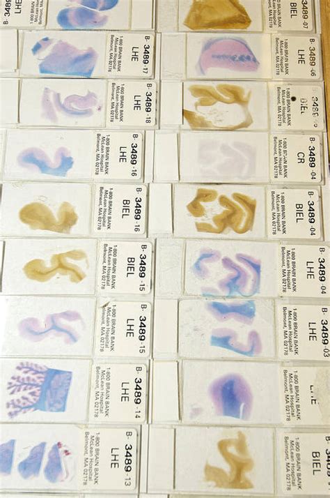 Microscope Slide Drawing
