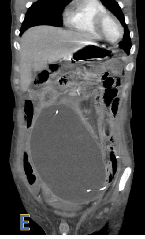 Radiology Manipal Hospital