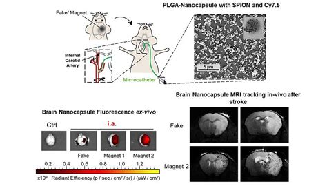Icmab A New Targeted Nanosystem Improves Brain Drug Delivery For The
