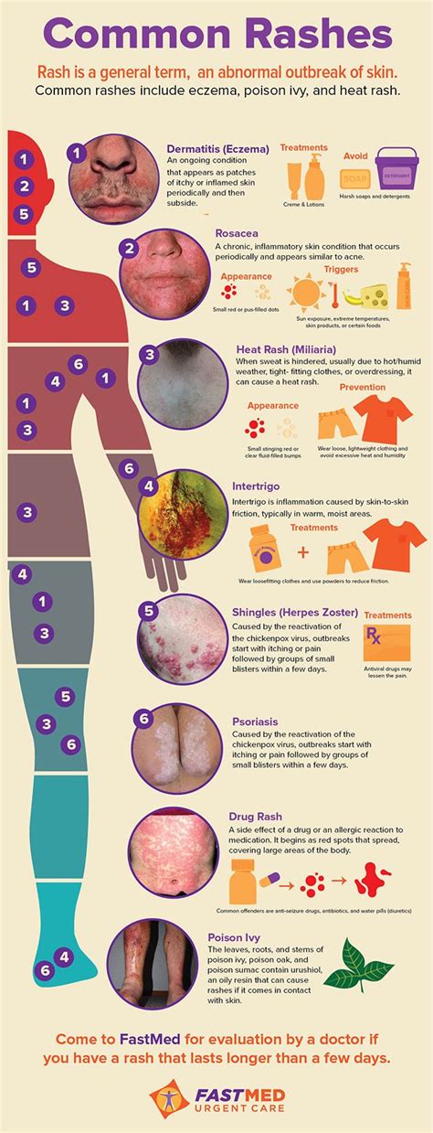 Pin On Common Medical Conditions