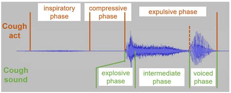 Past And Trends In Cough Sound Acquisition Automatic Detection And Automatic Classification A