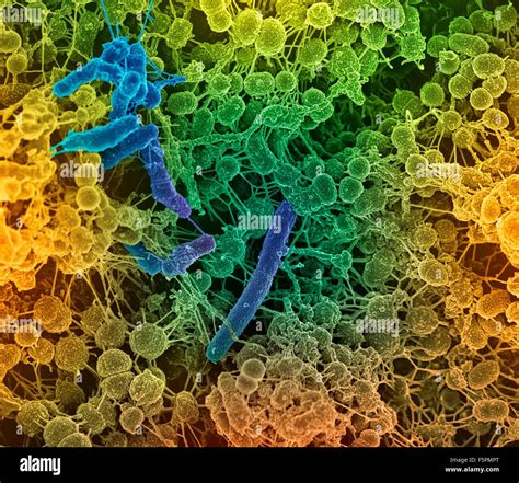 Oral Bacteria Coloured Scanning Electron Micrograph Sem Of Mixed Oral Bacteria Streptococcus