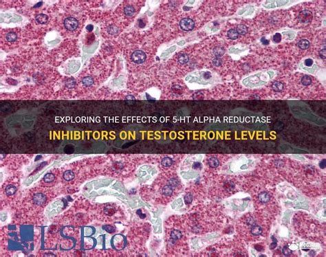Exploring The Effects Of 5 Ht Alpha Reductase Inhibitors On