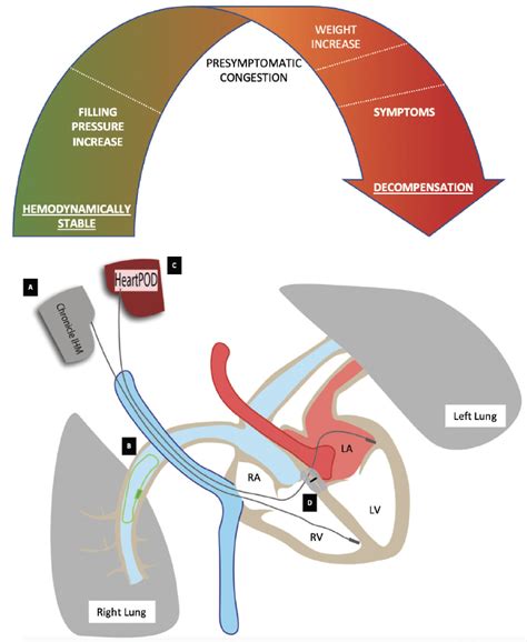 Hemodynamic Monitoring Cheapest Sales Gt