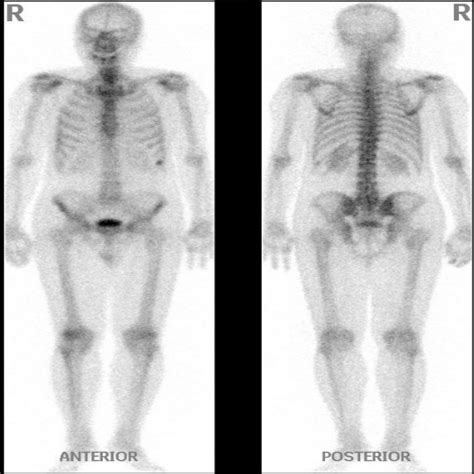 YOLO Object Detection Dataset By IIR