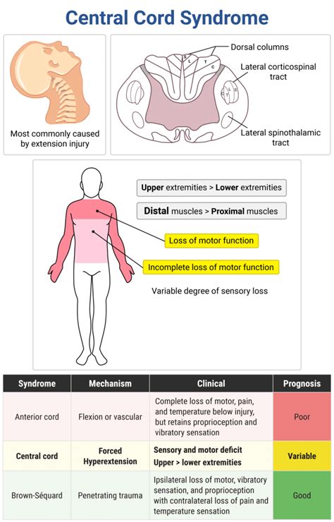 Rapid Review Central Cord Syndrome