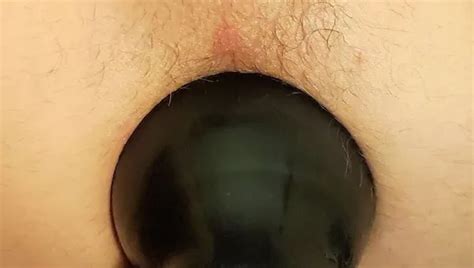 Anal Inflatable Dilation Of The Naughty Husband 5 Nude Pics Xhamster