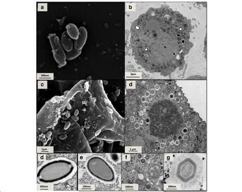 Electron Microscope Images Virus