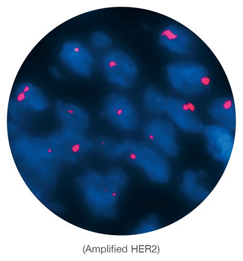 Cytocell Her2 Erbb2 Amplification Fish Probe