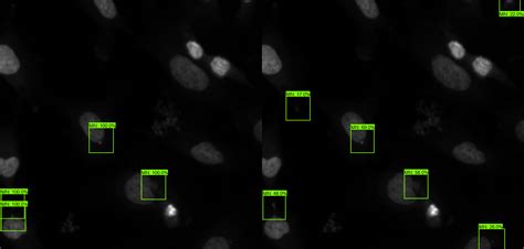 Cell Detection Workspace Weights And Biases
