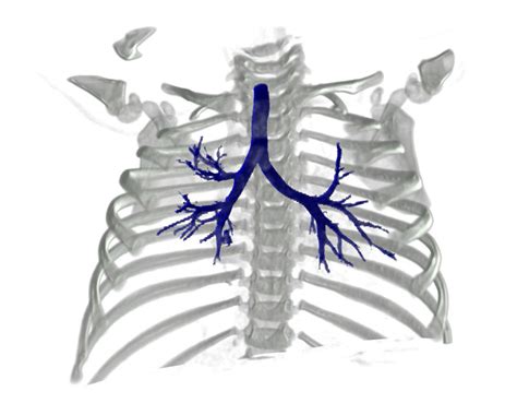 12 airway segmentation of a ct scan from a 20 month patient with download scientific diagram