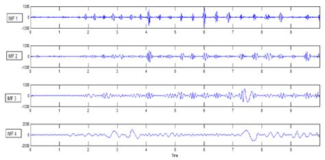 A Eeg Signal Before Decomposition Download Scientific Diagram