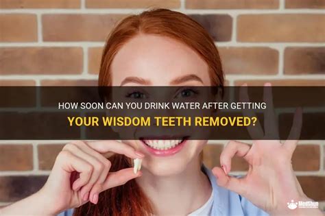 How Soon Can You Drink Water After Getting Your Wisdom Teeth Removed