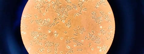 Applications Of Genetically Engineered Organoids And Cell Lines