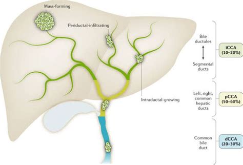 Cholangiocarcinoma Symptoms MEDizzy