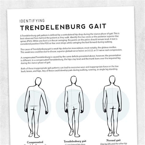 Identifying Trendelenburg Gait Etsy