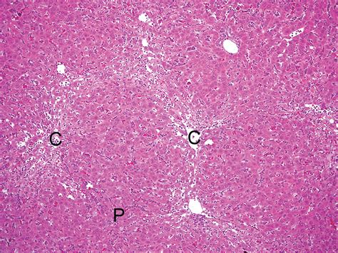 Centrilobular Liver
