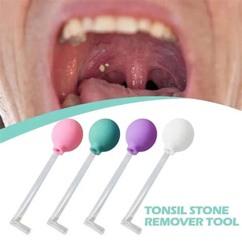 1 Set Tonsil Stone Remover Tool Kit Includes Pvc Suction Ball Oral