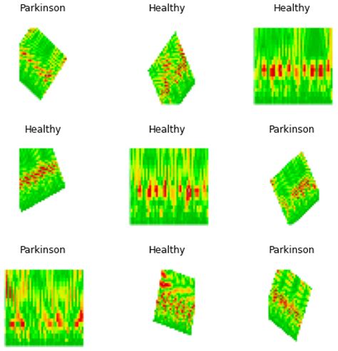 Biomedicines Free Full Text Modified Squeezenet Architecture For